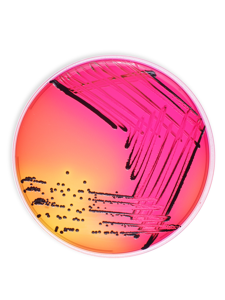 XLD agar (XLD) | BioVendor LM