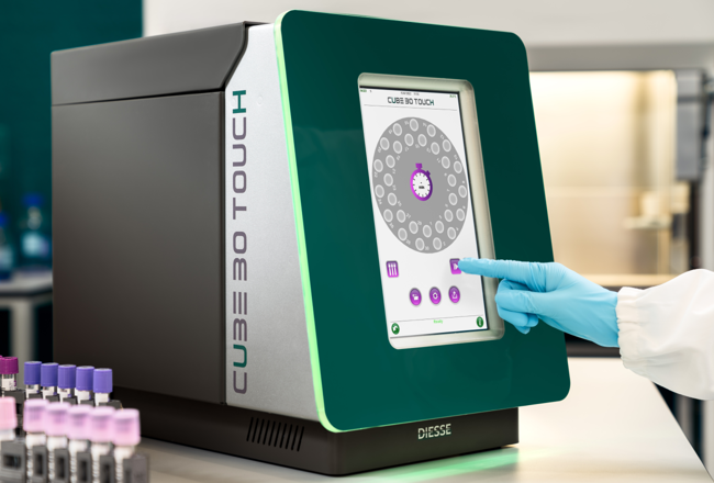 Automatizovaná sedimentácia erytrocytov | BioVendor LM